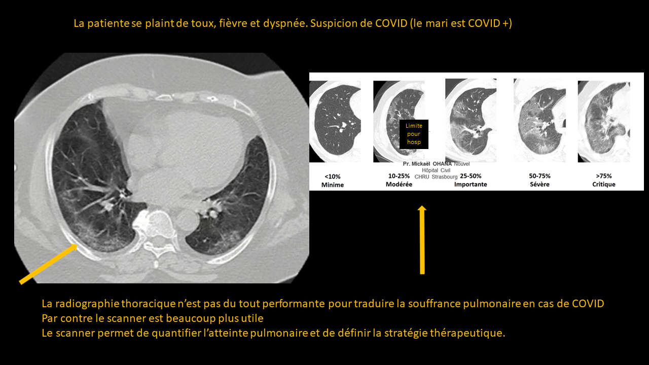Présentation clinico- radiologique 05 • CIL